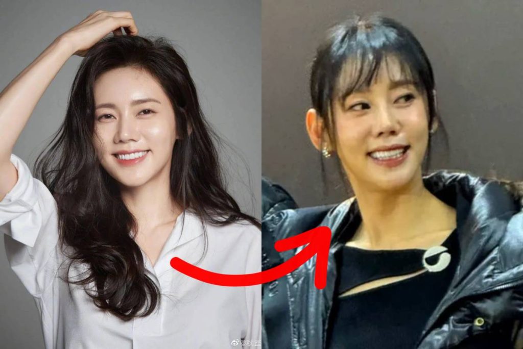 Once a Top Korean Bombshell, Choo Ja-hyun Sparks Concern After ...
